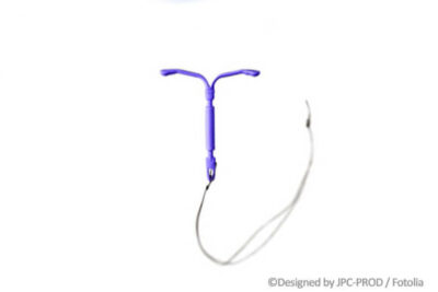 Hormonspirale: Wirkung, Kosten, Vorteile, Nachteile